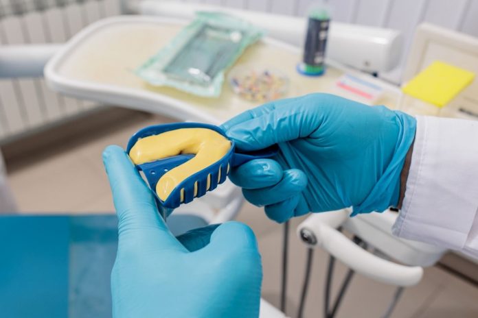 Materiali e tecniche per l'impronta dentale - Sanihelp.it