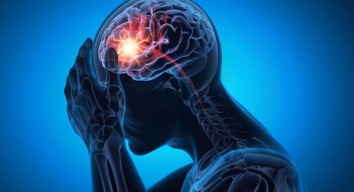 Aprile: mese della prevenzione contro l'ictus cerebrale - Sanihelp.it